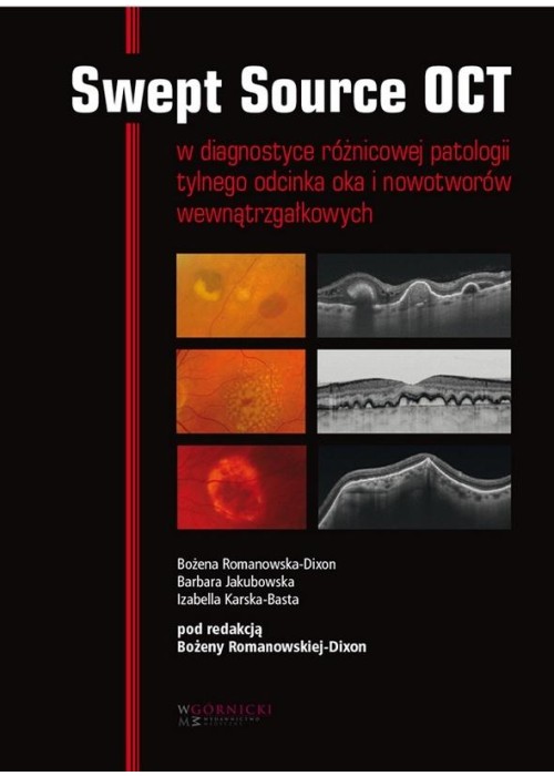 Swept Source OCT w diagnostyce patologii tylnego.. | Polska Księgarnia UK